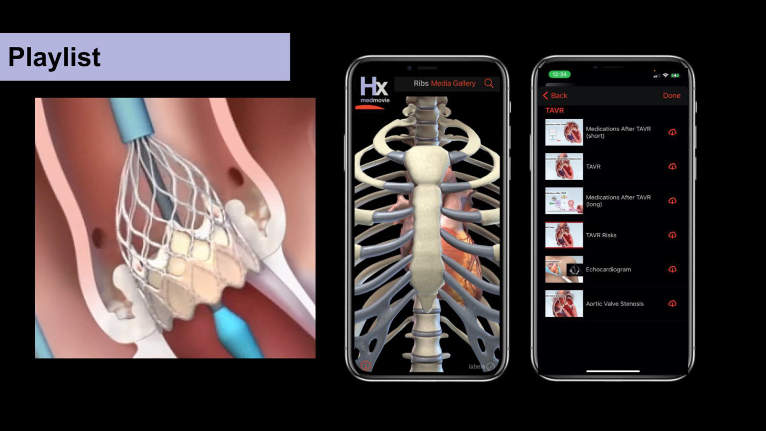 Hx VR – Medmovie.com