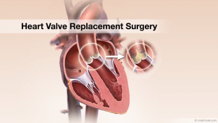 Cardiac Catheterization