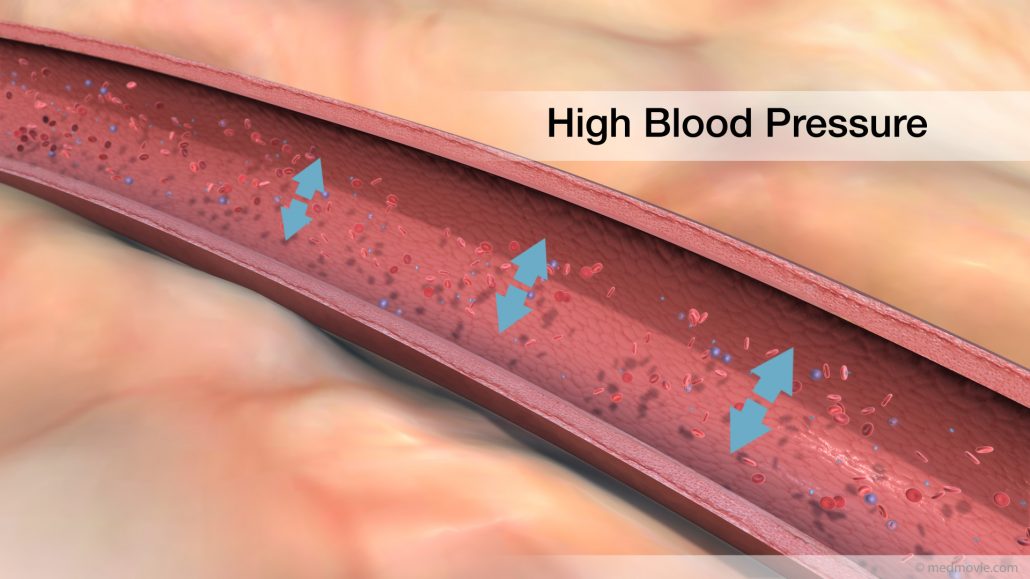 Coronary Arteries