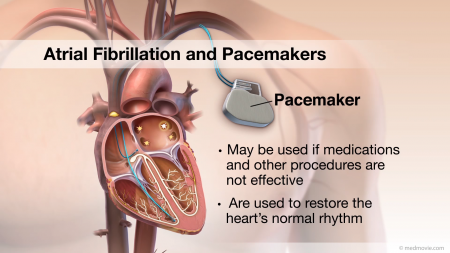 Radial Access Cardiac Catheterization