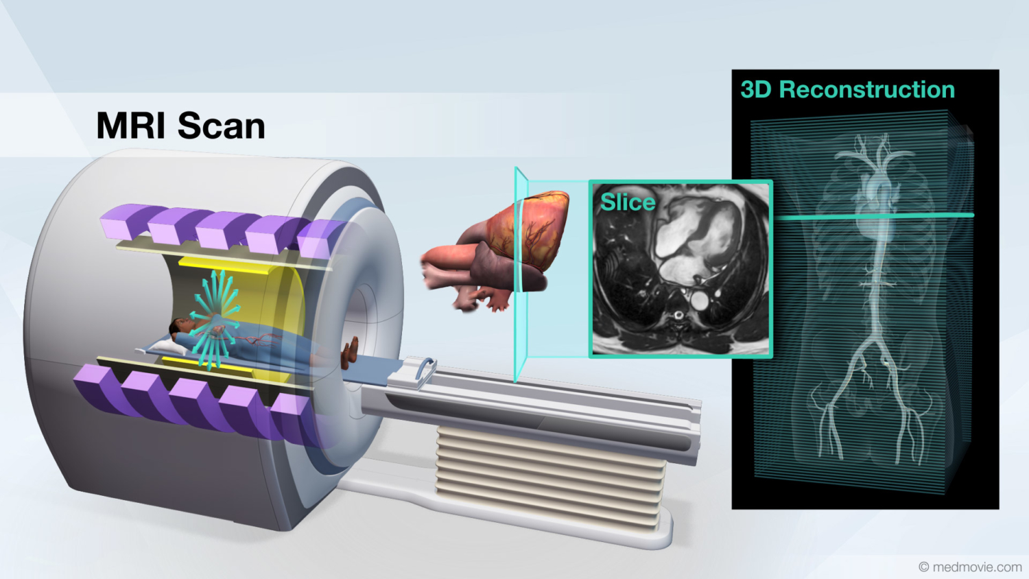 MRI Scan Image – Medmovie.com