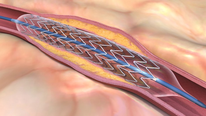 A Team Approach to Creating Custom Medical Animations – Medmovie.com
