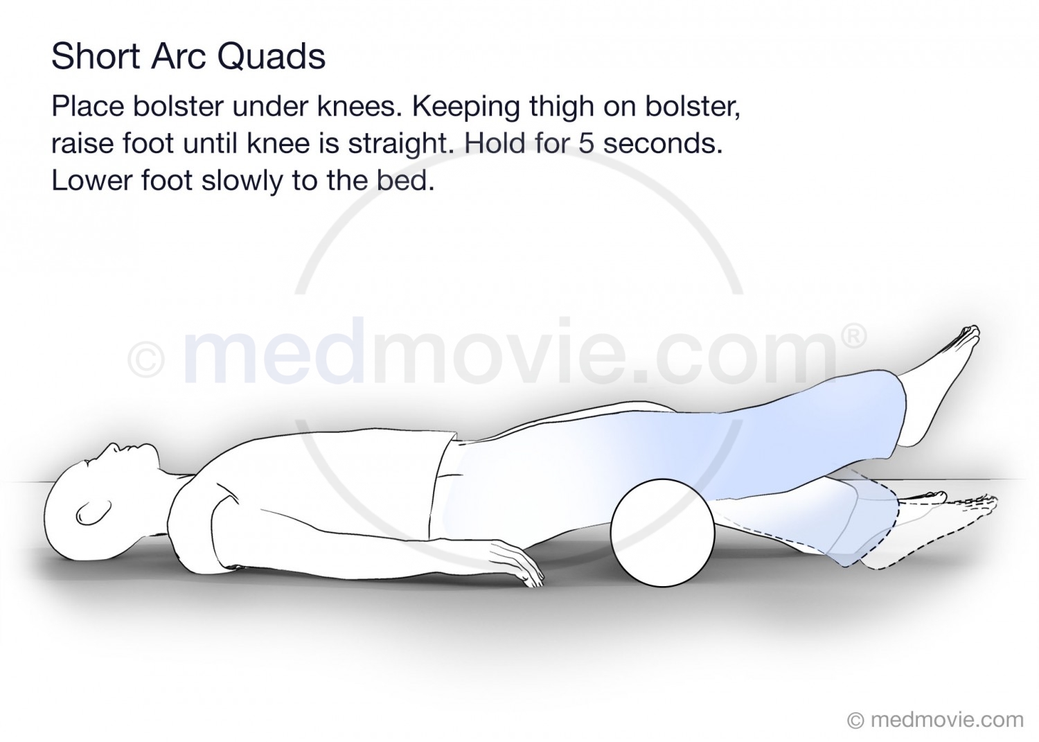 PT Short Arc Quads – Medmovie.com