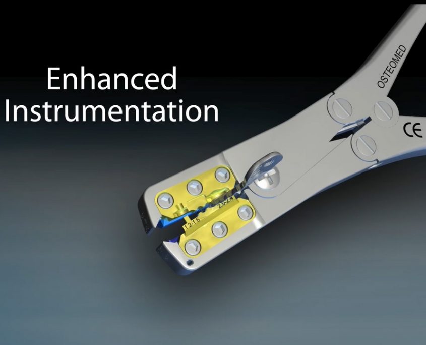 Medical Device Animation – Medmovie.com – Medmovie.com